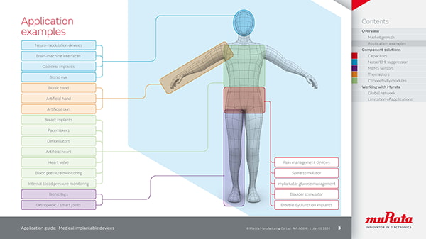 Application guide: Electronic components for Medical implantable ...
